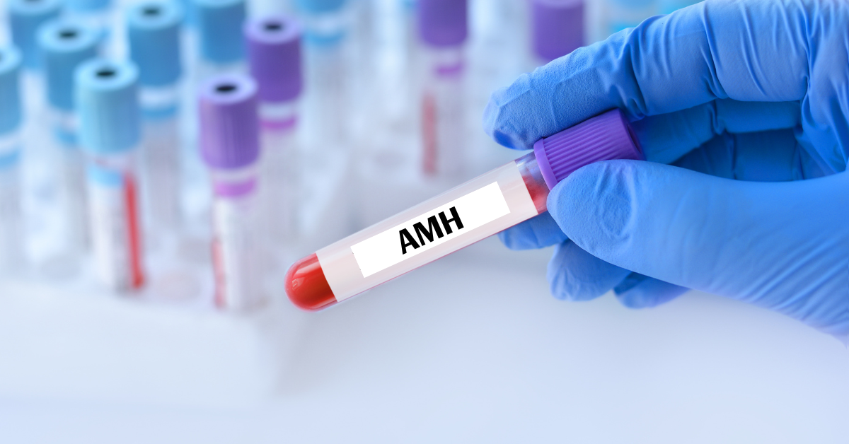 Koliko jajnih ćelija mi je još ostalo? Šta nam govori AMH?